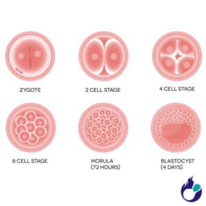 IVF, Blastocyst Culture and Transfer | Usha IVF