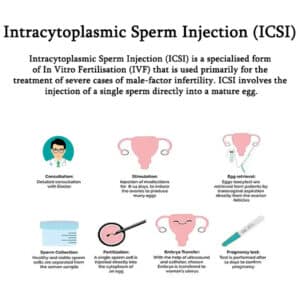 Overview:intracytoplasmic sperm injection (icsi) | Usha IVF