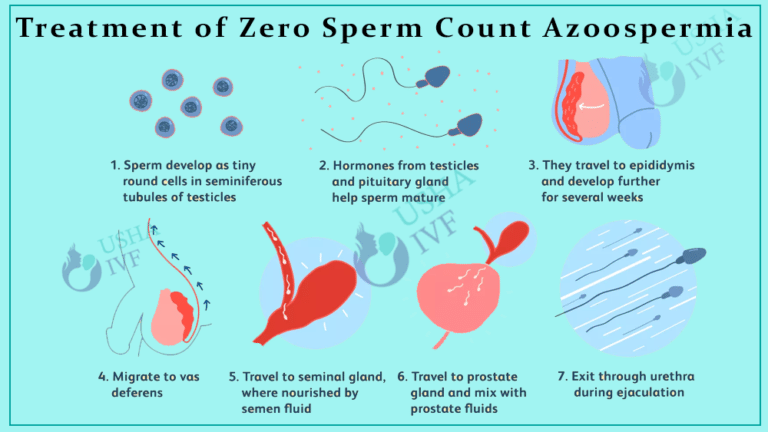 Treatment of zero sperm count Azoospermia | Usha IVF